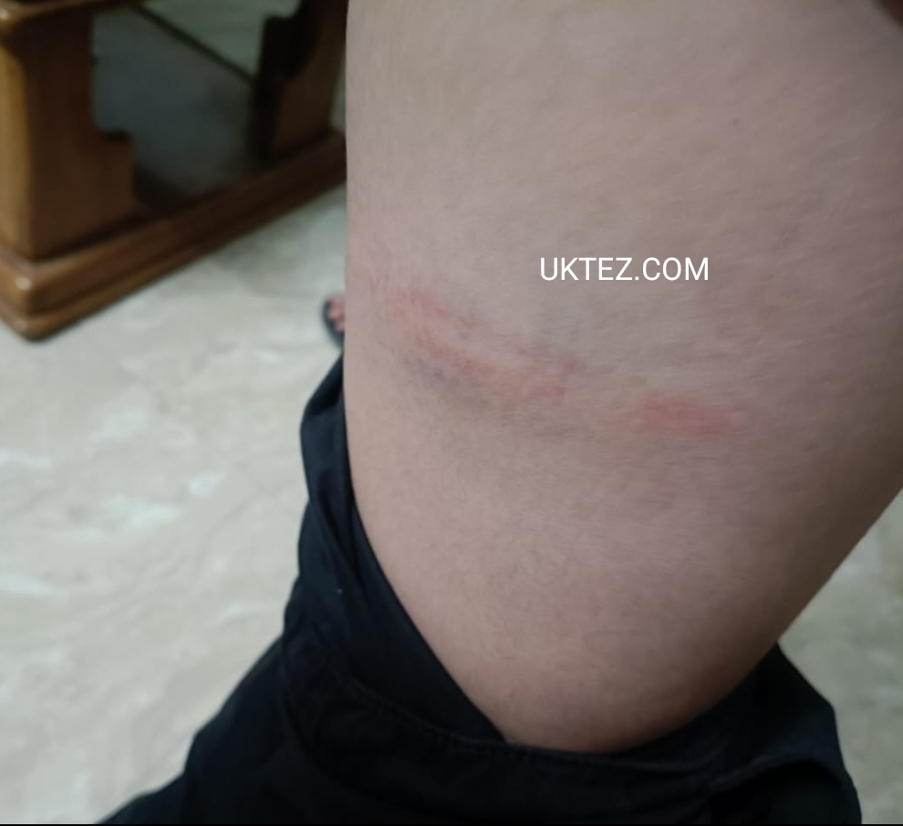 डोईवाला के भानियावाला में ट्यूशन टीचर ने डंडे से पीटा स्टूडेंट को - uktez.com